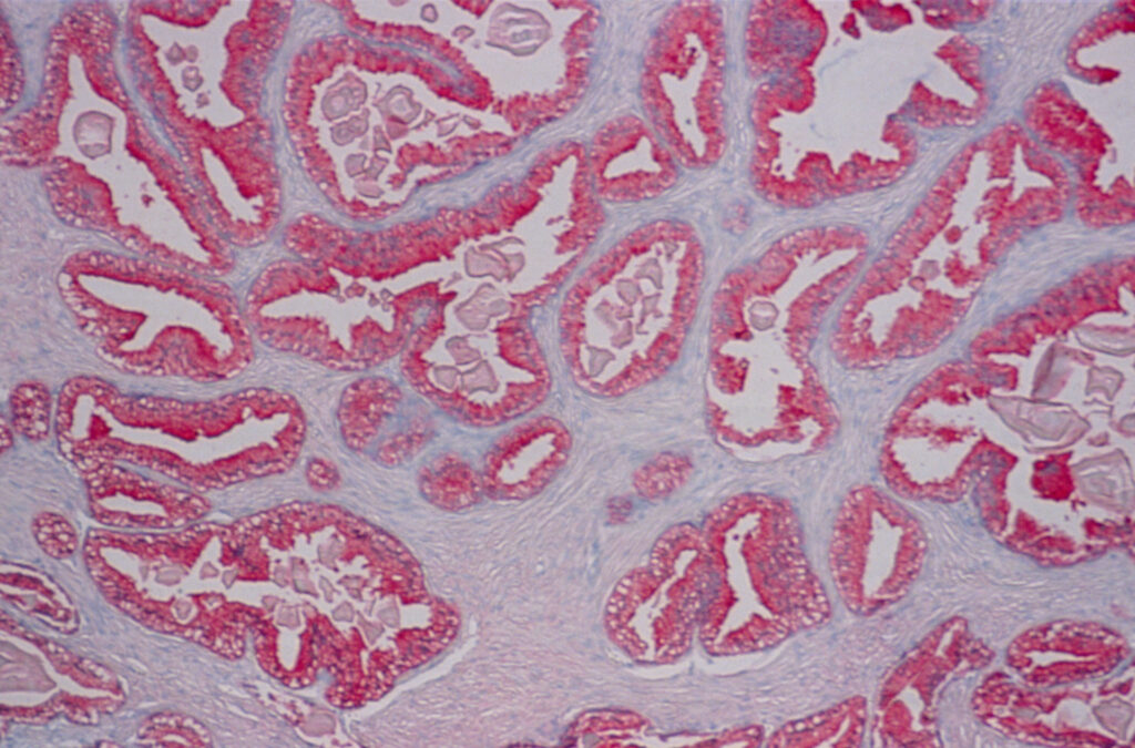 Fast Red substrate/chromogen 2-component system – Innovex