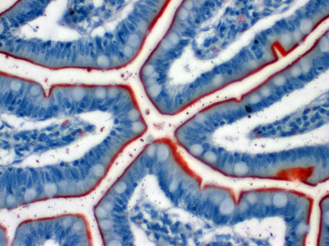 Stable Liquid AEC substrate/chromogen 2-component system – Innovex
