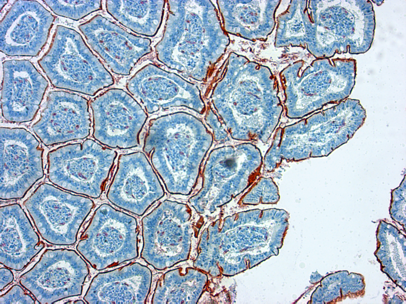 Stable Liquid AEC substrate/chromogen 2-component system – Innovex